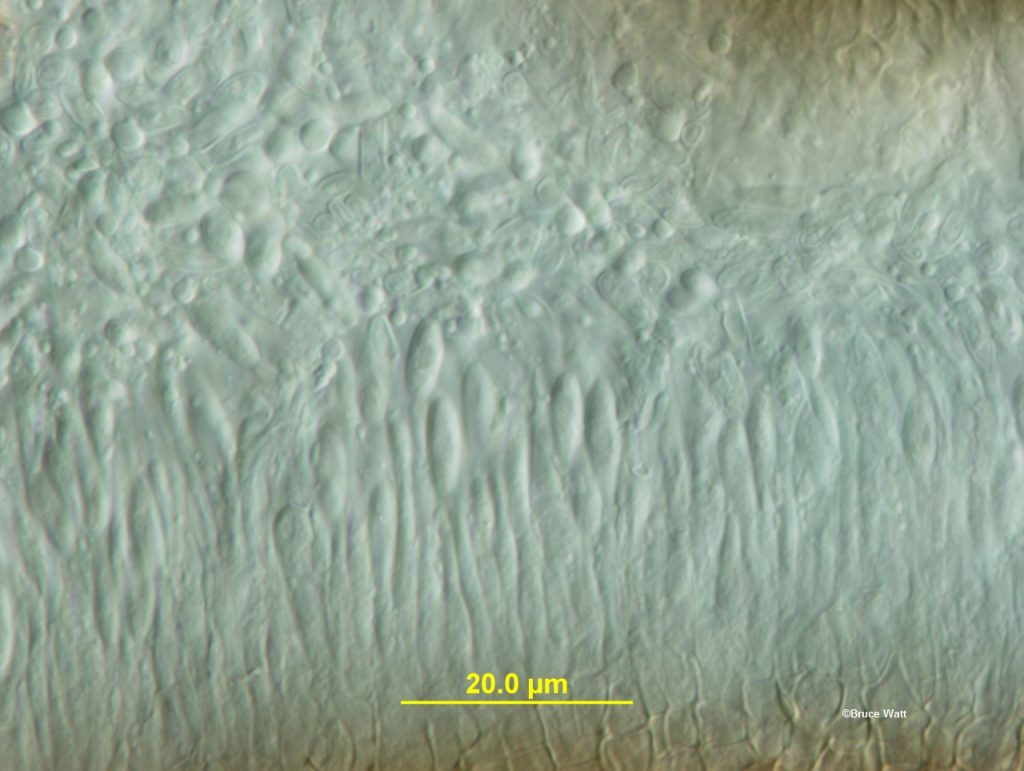 Juniper - Phomopsis Blight - Cooperative Extension: Insect Pests, Ticks ...