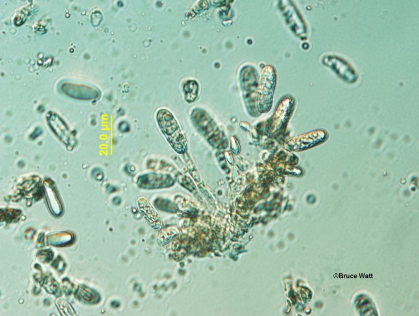 Fir - Rhizosphaera Needle Cast - Cooperative Extension: Insect Pests ...