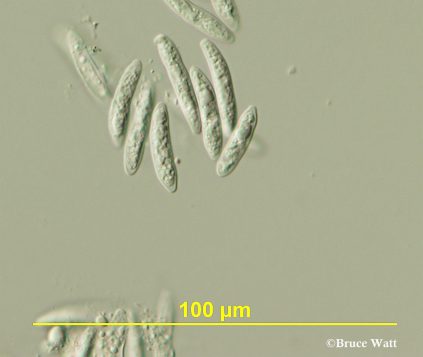 Raspberry - Anthracnose - Cooperative Extension: Insect Pests, Ticks ...