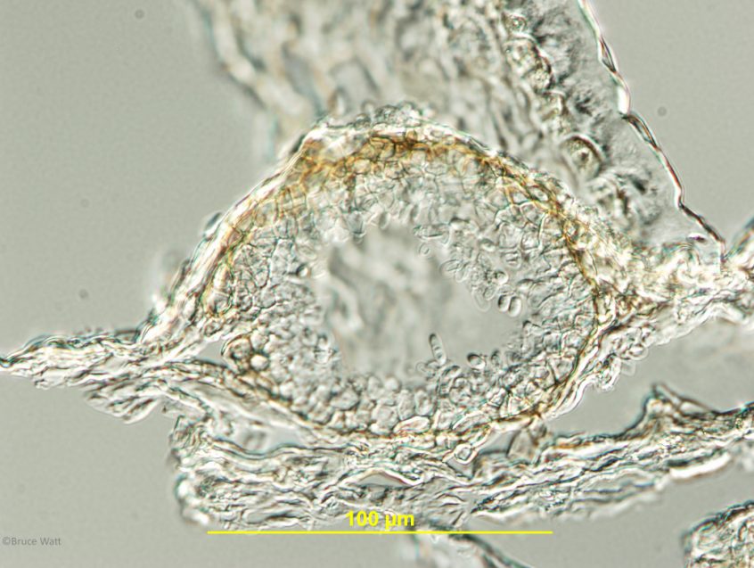 Lilac - Ascochyta Blight - Cooperative Extension: Insect Pests, Ticks ...